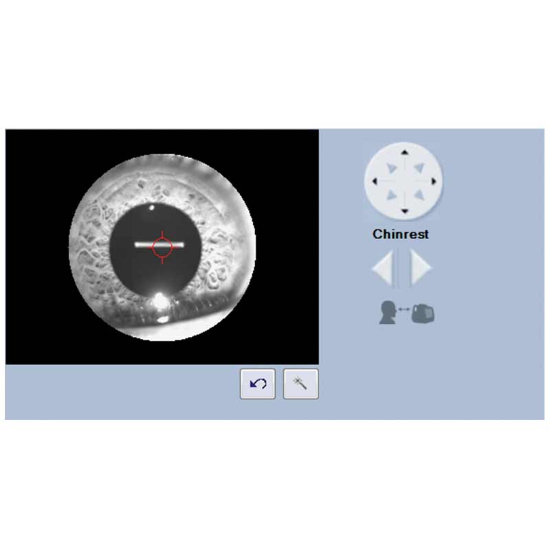 Zeiss Cirrus HD-OCT 500 - Medilex equipment suppliers