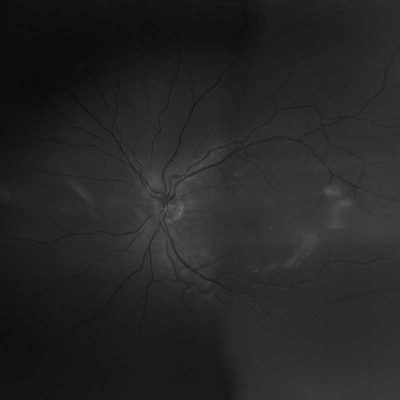 Zeiss Clarus 700 - Medilex