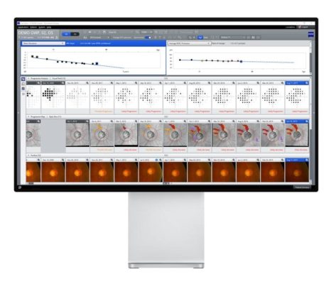 ZEISS Glaucoma Workplace - Medilex